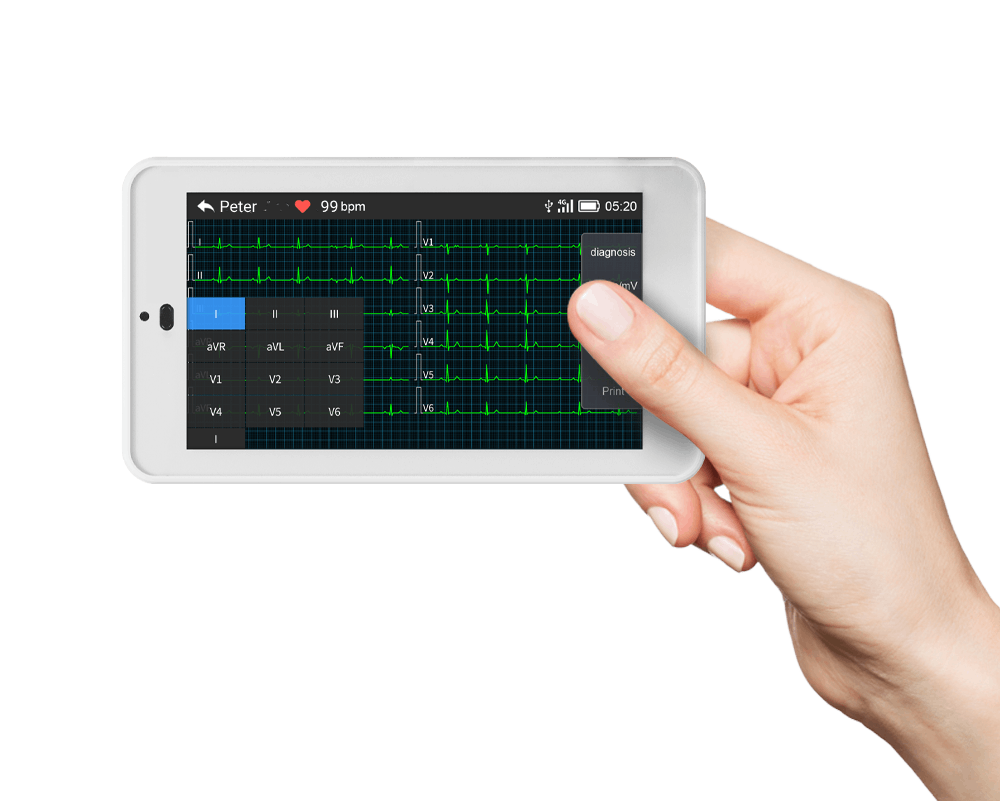 Mobile 6/12-Lead EKG/ECG Machine Fits into Your Pocket, with Auto Interpretation, Wirelessly ...